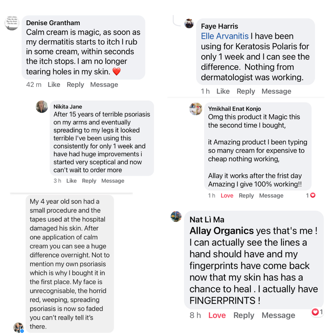 Calm Cream- Best Natural Cream For Psoriasis, Eczema and Dermatitis ...